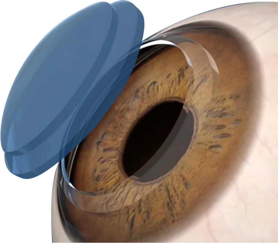 Vivekananda Netralaya – Super Specialty Charitable Eye hospital